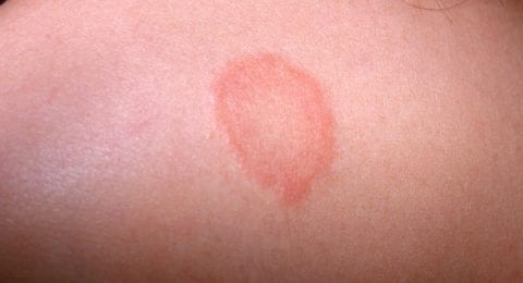 Dermatofitoza la puii de catel - E-vet